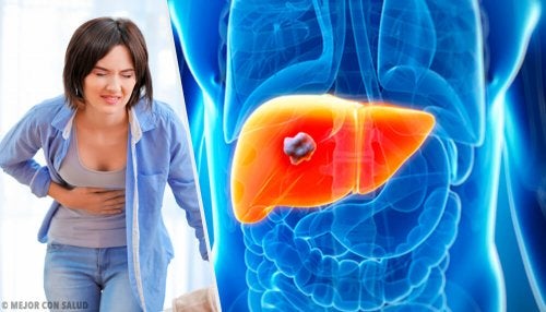 Tot ce trebuie sa stiti despre angiomul hepatic - Arisinvest